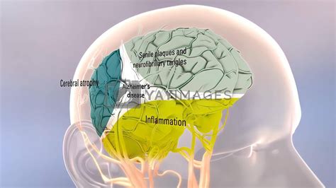 Amyloid Precursor Protein Processing And Alzheimer S Disease By