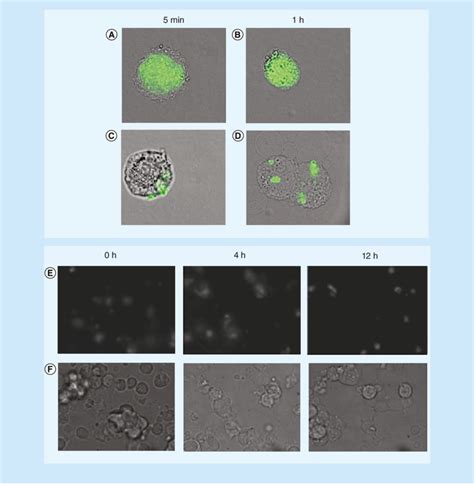 Intracellular Kinetics Of Plasmids After Sonoporation A And B Download Scientific Diagram