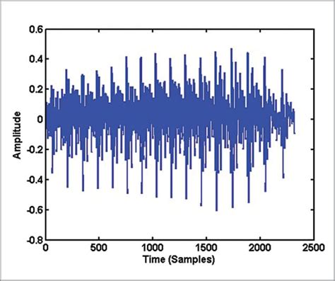 Understanding Spectrogram Of Speech Signal Using Matlab