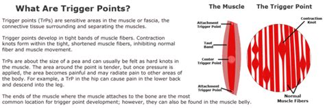 Popliteus Muscle Pain And Stiffness Behind The Knee The Wellness Digest