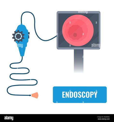 Gastroscopy Procedure Of Stomach Examination With Endoscope Stock