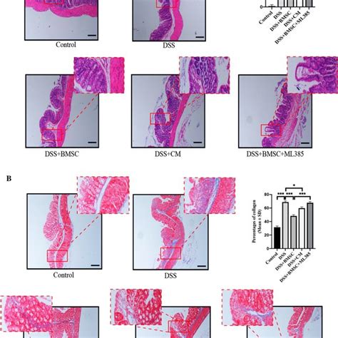 Bmscs And Cm Reduce The Infiltration Degree Of Inflammatory Cell And