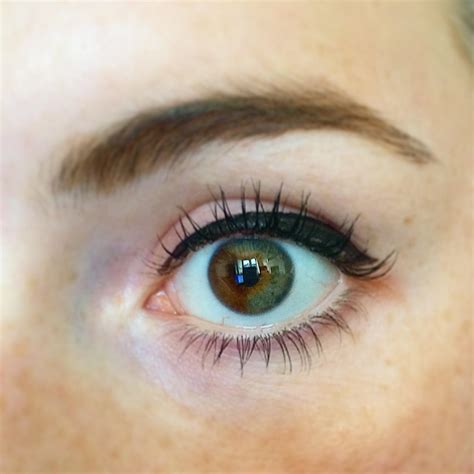 Heterochromia Iridum Donn Gorm