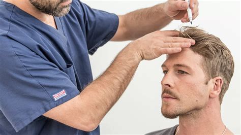 What Is Scalp Reduction Surgery 3 Facts To Transform Your Hairline Hair Transplant Clinic By
