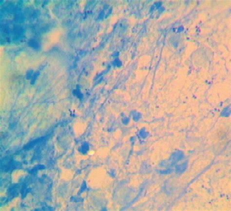 Bacterial Skin Infections Including Pyoderma Vet Times