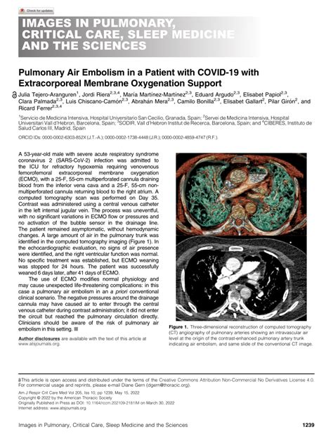 Pdf Pulmonary Air Embolism In A Covid 19 Patient With Ecmo Support