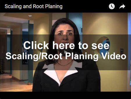 Scaling And Root Planing Dimitri G Ganim DDS