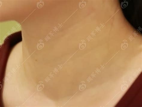 别低头颈纹会笑你和女神之间只差一个天鹅颈