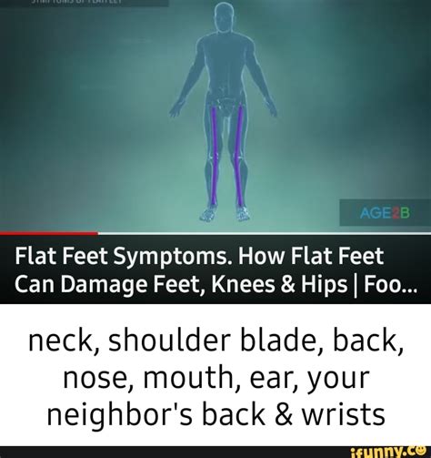Flat Feet Symptoms How Flat Feet Can Damage Feet Knees And Hips I Foo