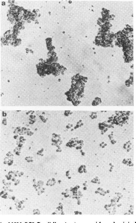 Figure 1 From Laminin Receptors On Sclc Cells Semantic Scholar