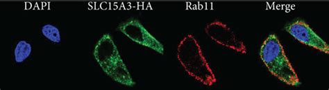 Slc15a3 Is Located At Lysosomes Late Endosome And Peroxisome