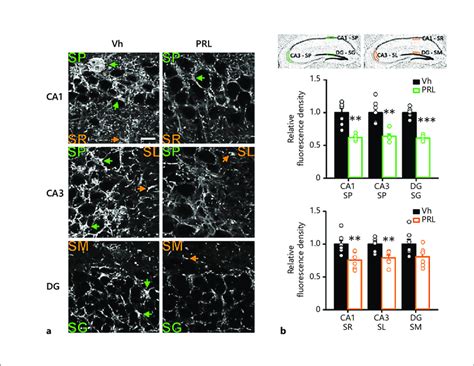Increase In Prl Level Decreases Pv Expression In The Hippocampus A Download Scientific Diagram