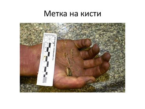Электротравмы - презентация онлайн