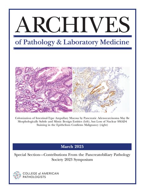 Measurable Residual Disease Analysis By Flow Cytometry And Correlation With Molecular Measurable