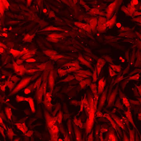 Red Fluorescent Immortalized Human Colonic Fibroblasts Innoprot