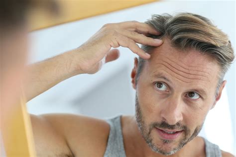Finasteride And Minoxidil Hair Loss Therapy Lloydspharmacy