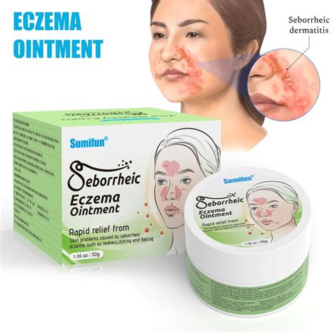 30g Seborrheic Eczema Ointment Fast Acting Treatment Seborrheic Relief