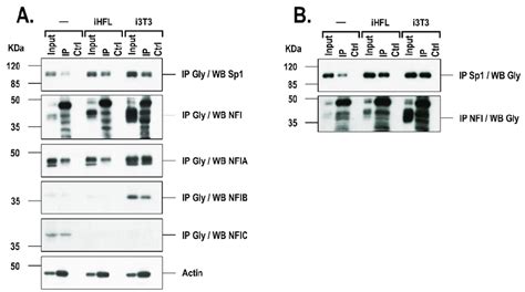Post Translational Glycosylation Of Sp1 And Nfi In Hcecs Cultured With