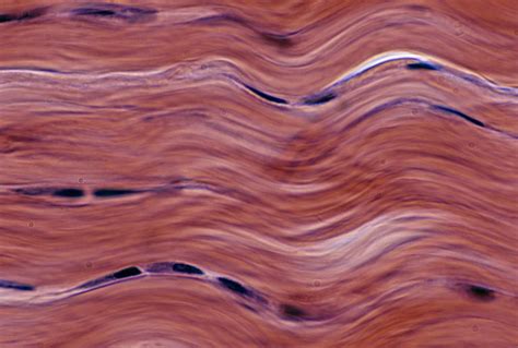 Connective Tissue Types And Examples
