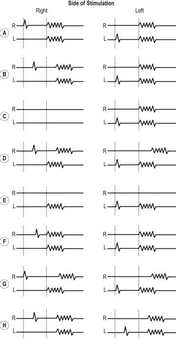 Blink Reflex Musculoskeletal Key
