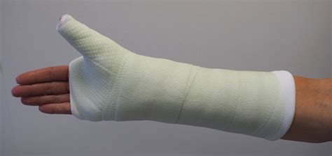 Broken Wrist Blank Template Imgflip