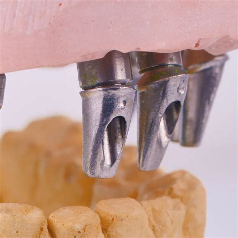 میلینگ سنتر ماخ دندانسازی تمام دیجیتال