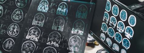 Refaat El Said Md Dr Refaat El Said Doctor Refaat El Said