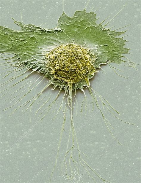 Bronchial Epithelium Sem Stock Image C0226442 Science Photo Library