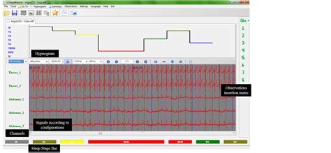 Software Tool Development And Application Focusing In Edf Signal
