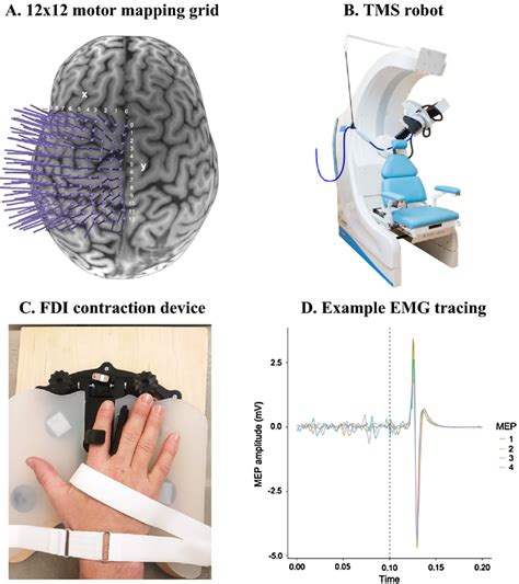 Neuro Navigated Robotic Tms Motor Mapping During Isolated Fdi Download Scientific Diagram