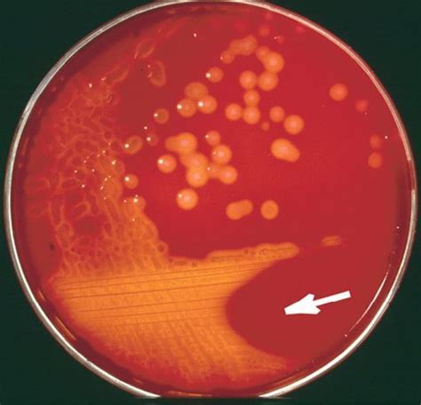 Staphylococcus Vs Streptococcus • Microbe Online