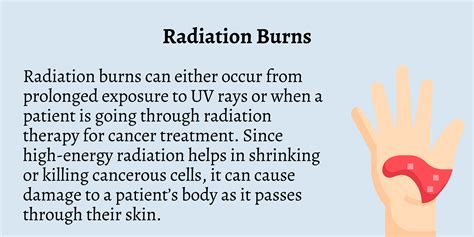 What Is The Initial Treatment For A Burn At Jaime Hodges Blog