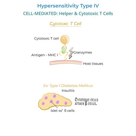 Clinical Pathology Glossary Hypersensitivity Type Iv Ditki Medical