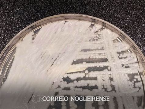 Estado De SP Confirma Primeiro Caso De Superfungo Candida Auris Correio Nogueirense