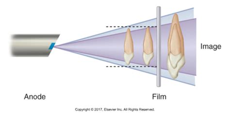 Dental Radiography Paralleling Technique Chapter Flashcards Quizlet