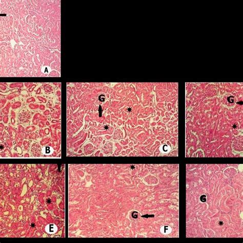 Photomicrographs Of Testis Of The Adult Male Albino Rats Hand E X200