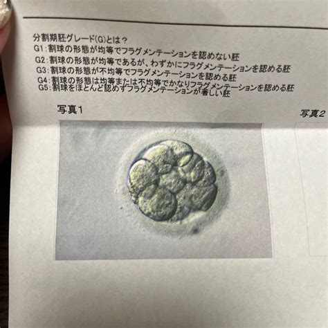 ~凍結胚移植~ 3日目初期胚 ʕ •ᴥ•ʔ ʕ·ᴥ·ʔ 記録用