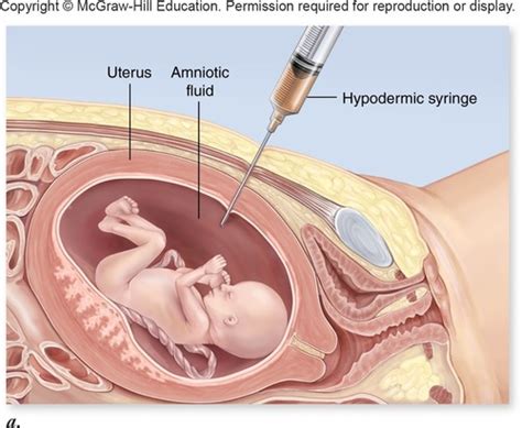Chapter 13 Chromosomes Mapping And The Meiosis Inheritance Connection Flashcards Quizlet