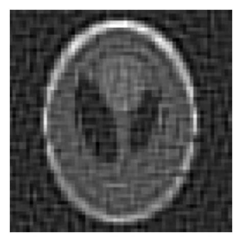 A True Image B Blurred And Noisy Image C Restored Image With