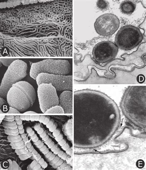 Panel Of High Resolution Scanning Electron Microscopy Hrsem And