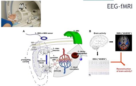147 Eeg Fmri Bs2010 Bioimaging