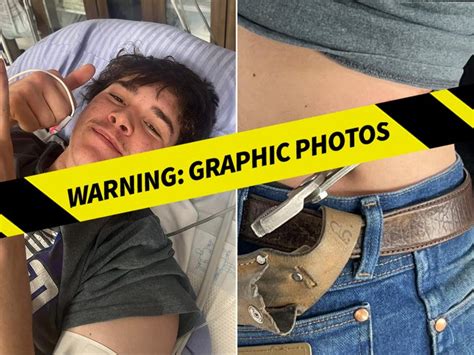 Kansas Teen Impaled By Pliers In Freak Accident Graphic Injuries