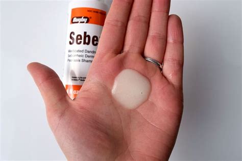 Review Sebex Medicated Shampoo