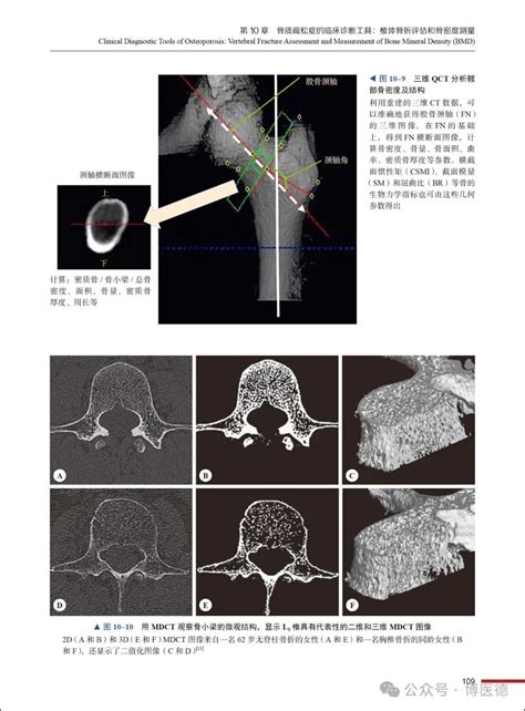 新书上架：骨质疏松性骨折与骨病 好医术文章 好医术 赋能医生守护生命