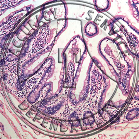 Ileum Human Prepared Microscope Slide