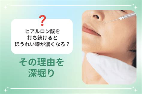 ヒアルロン酸を打ち続けるとほうれい線が濃くなるの？その理由を深堀り 梅田すずらんクリニックブログ