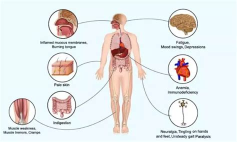 5 Signs Of Vitamin B12 Deficiency