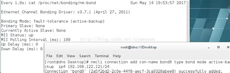 Linux之bound网络配置linux配置bound Csdn博客