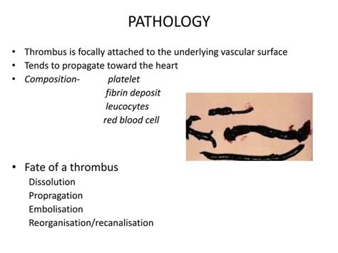 Principles Of Dvt Prophylaxis Ppt
