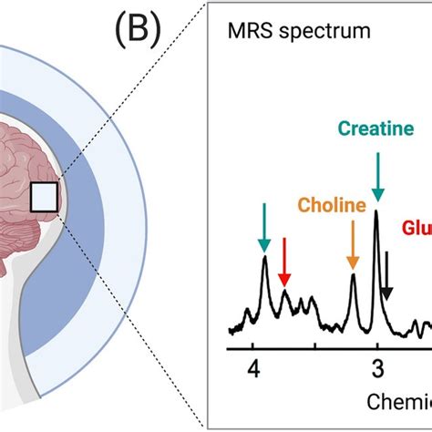 General Scheme Of Mrs A Metabolite Signals Are Acquired Using An Mrs